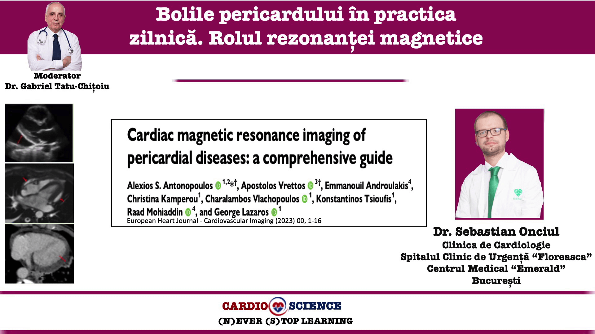 20 - 2024 MRI în bolile pericardului. 01 februarie 2024 - CardioScience